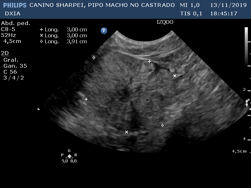 Comparativa de varios pacientes con masas abdominales intestinales en ...